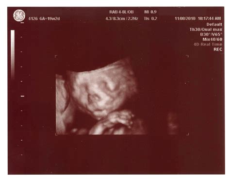 Notes From My Fridge Sonogram Saysits A Boy