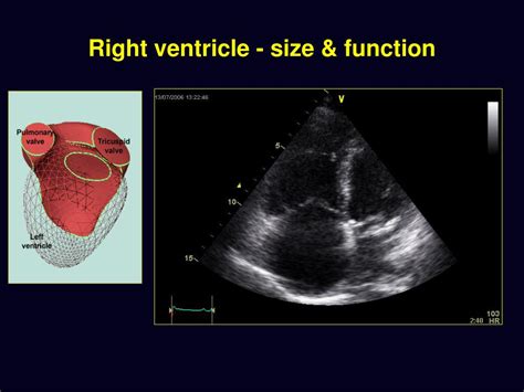 Ppt Basic Echocardiography Powerpoint Presentation Free Download