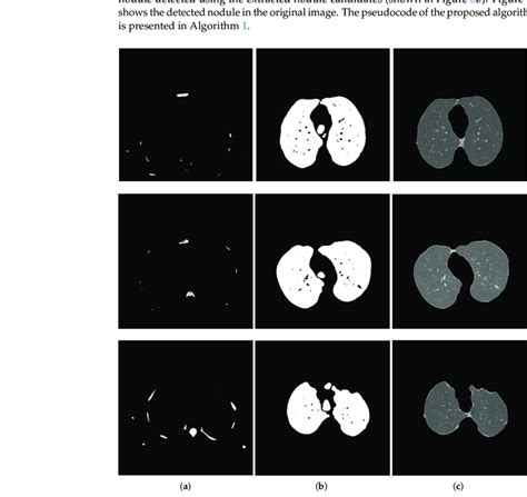 A Segmentation Results Using The Global Mean As The Threshold B