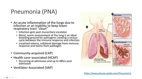 Acute Pulmonary Pathophysiology 1 Atelectasis Bronchitis And Pneumonia Youtube