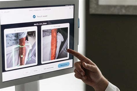 Understanding Burn Diagnosis Spectralai