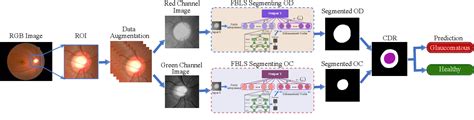Figure 1 From Optic Disc And Cup Segmentation Through Fuzzy Broad Learning System For Glaucoma