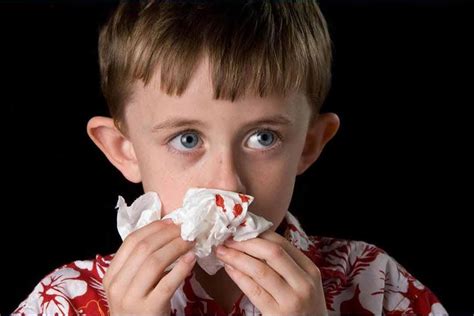 ما أسباب نزيف الأنف المستمر عند الأطفال؟ إليك طرق علاجه الكونسلتو