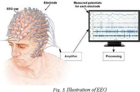 Figure 1 From Eeg Based Human Emotion Recognition Using Deep Learning
