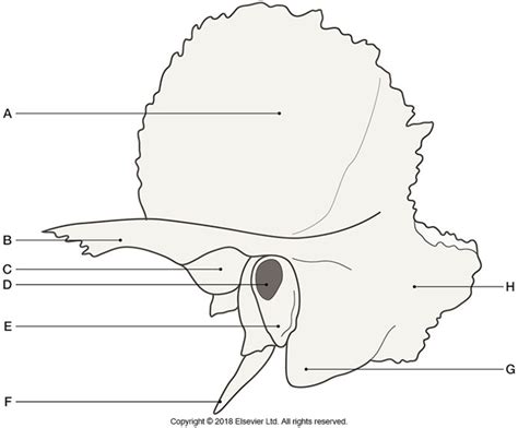 Anatomy Of The Left Temporal Bone Key Terms And Definitions Flashcards