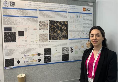 Zahra Yazdani On Linkedin Network Neuroscience Neuroscience Unet Can Acn 13 Comments