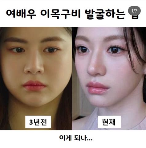 의사에게 물어보세요 19살 곧 성인입니 강남언니 1등 성형수술and피부시술 정보앱