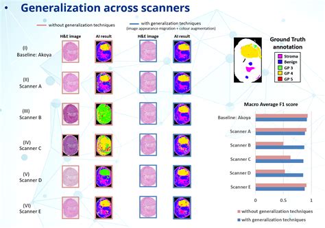 A Comprehensive Ai Model Development Framework For Consistent Gleason Grading Research
