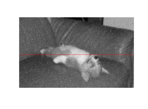 2 non overlapping domain decomposition algorithm for l 1 tv