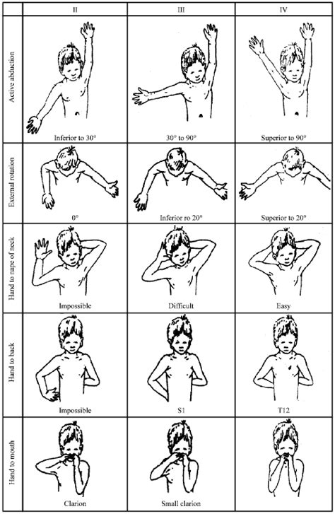 Mallet Classification Brachial Plexus At Jorge Damon Blog