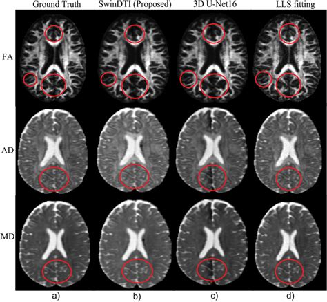 32 Dwis Diffusion Directional Signal Compared With Swindti Proposed Download Scientific