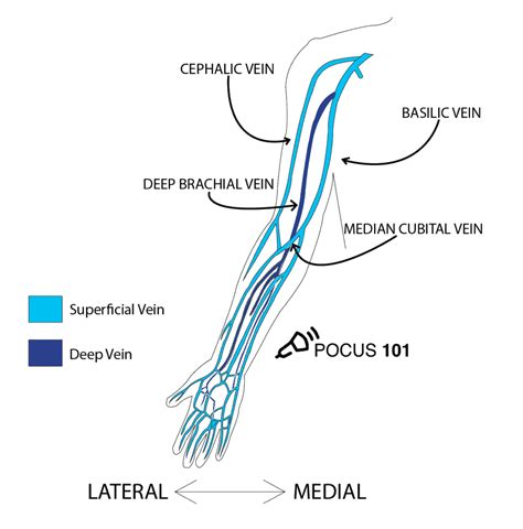 Iv Infiltration Diagram