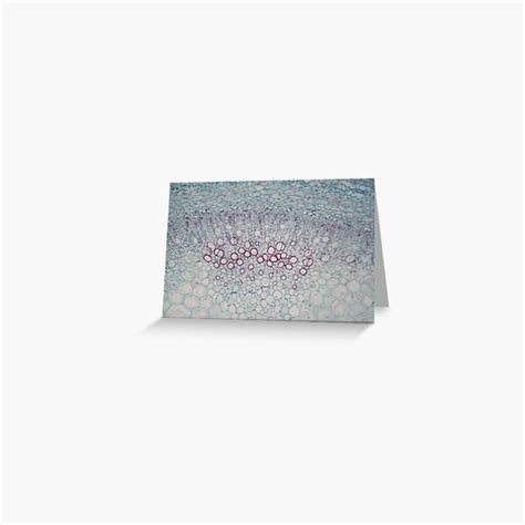 Sambucus Stem With Parenchyma Cells Under The Microscope Greeting Card By Zosimus Redbubble