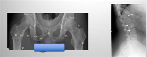 Heme Onc Exam Practice Questions Flashcards Quizlet