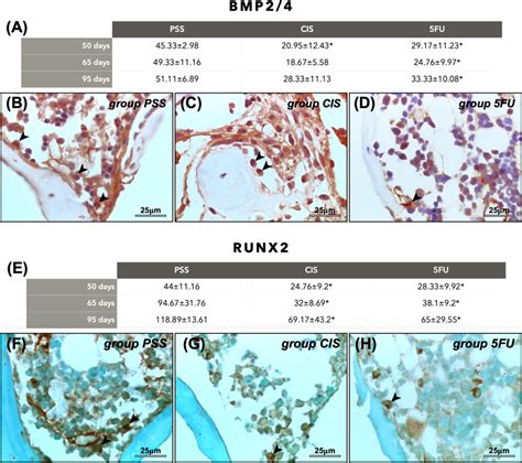 Immunolabeling Pattern Of Bmp24 Ad And Runx2 Eh At The
