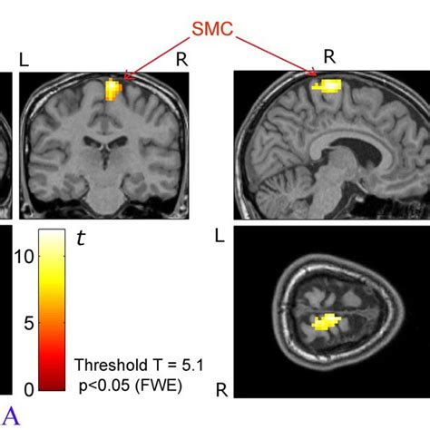 Typical Activation In Primary Sensorimotor Cortex Smc Obtained From Download Scientific