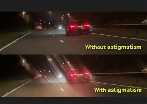 Experts Warn That 27 Of Brits Are Living With A Common Eye Condition Known As Astigmatism