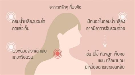 รู้ทัน ต่อมน้ำเหลืองอักเสบ โรคที่เป็นได้ทุกเพศ ทุกวัย