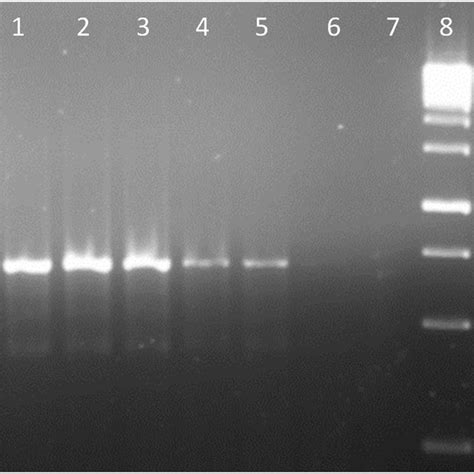 Limit Of Detection Of The Bdha Pcr Assay Lane 1 100 Ng Gdna Lane 2 Download Scientific