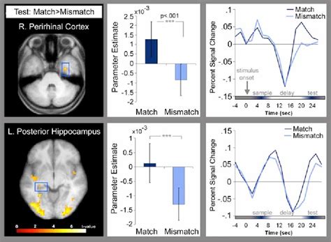 Figure 1 From Medial Temporal Lobe Activity Predicts Successful