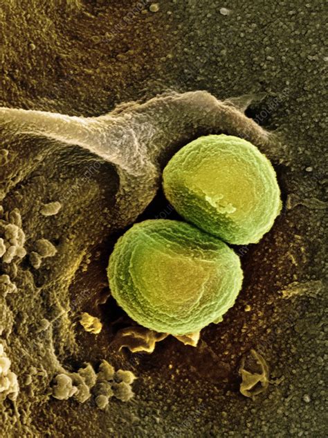 Staphylococcus Aureus Bacteria SEM Stock Image C006 6699 Science Photo Library