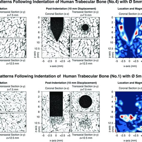 Compaction Patterns Following Indentation Of Human Bone Specimens With Download Scientific