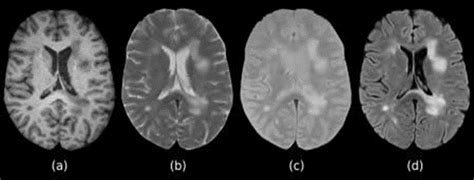GitHub AHMEDSANA Binary Class Brain Tumor Segmentation Using UNET We Segmented The Brain