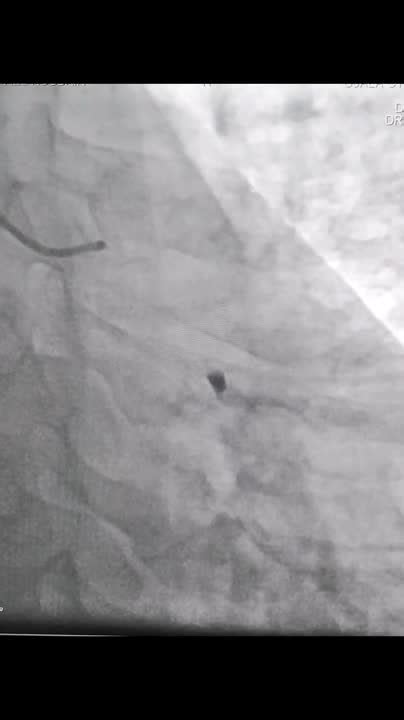 Dr Wasim Ahmed On Linkedin Ultimate Cricket Fan Insisted On Live Cricket Commentary Instead Of…