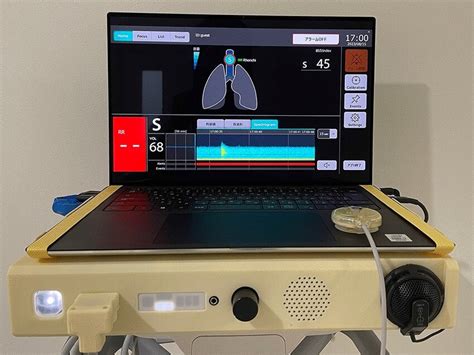 The Respiratory Sound Monitoring System Comprises Sensors For Detecting Download Scientific