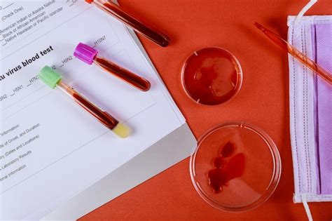 Premium Photo Blood In Test Tubes And Results Of Testing Positive For Flu Virus