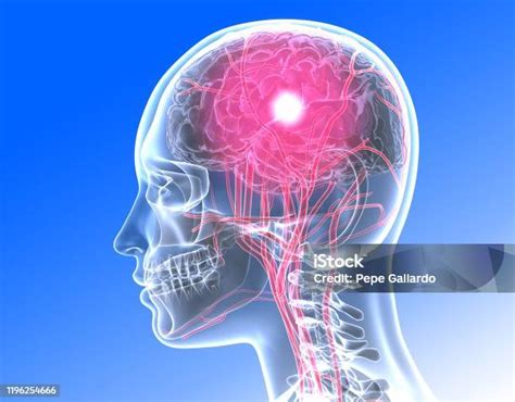 3d 그림 뇌의 내부 장기와 활동과 투명 인간의 머리 Ilustración X 레이에 대한 스톡 사진 및 기타 이미지 X 레이 머리 엑스레이 이미지 Istock