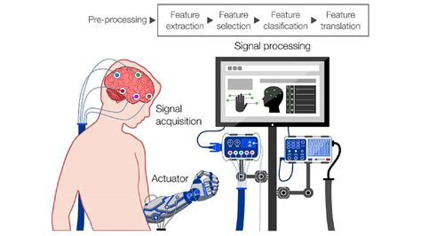 Eeg Brain Mosapje