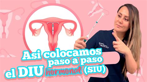 Así Colocamos Paso A Paso El Diu Hormonal Siu En Vivo Youtube