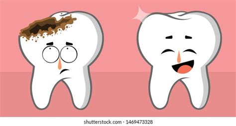 Cartoon Decayed Tooth Healthy Tooth Stock Vector Royalty Free