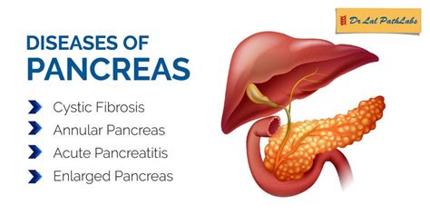 Pancreas Functions Diseases And Diagnosis Dr Lal Pathlabs
