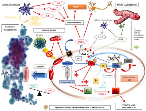 Endometriosis Update Of Pathophysiology Epi Genetic And Environmental Involvement