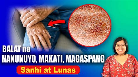 40 Anyos Pataas Nanunuyo Magaspang Makating Balat Dry Skin