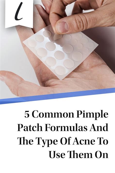 5 Common Pimple Patch Formulas And The Type Of Acne To Use Them On The List