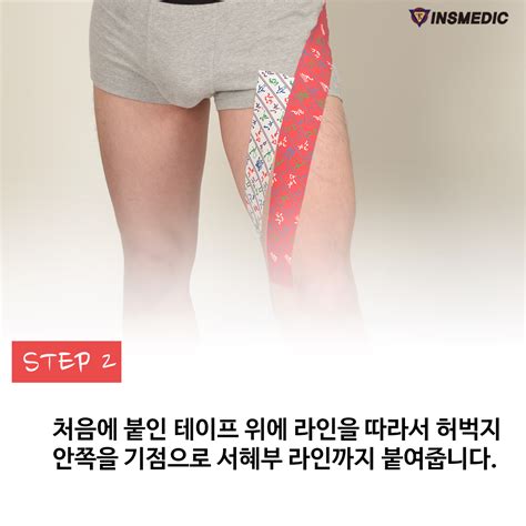 국제테이핑 골반 안쪽의 통증에 도움되는 키네시오 테이핑 방법 한 번 알아볼까요 사진 속 제품이