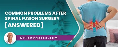Common Problems After Spinal Fusion Surgery [answered]
