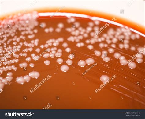 Стоковая фотография 1174620349 Colonies Cryptococcus Neoformans On