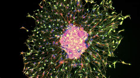Induced Pluripotent Stem Cell Core Facility On Linkedin Ucla Study