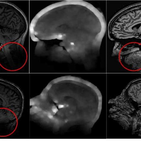 Pdf A Local Active Contour Model For Image Segmentation With Intensity Inhomogeneity