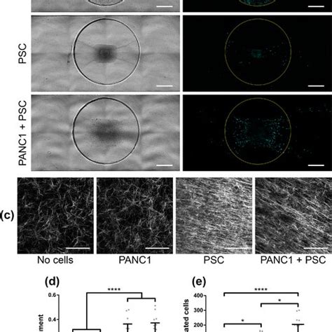 Quantification Of Collagen Fiber Alignment And Total Cells Migrated Download Scientific Diagram