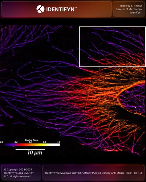 Microscopy Superresolutionmicroscopy Fluorescence Antibodies