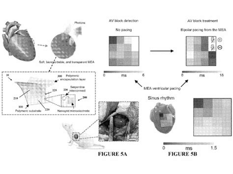 Bioresorbable Microelectrode Array Implant For Cardiac Conditions Bioworld