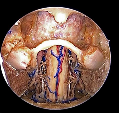 Anterior View Of Proximal Cervical Segment Of The Spinal Cord