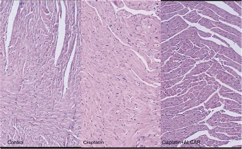 Microscopic Appearance Of The Myocardium Within Normal Limits