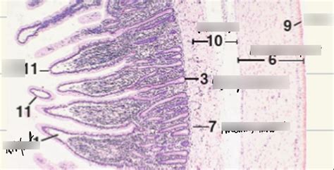 Diagram Of Histology Duodenum Quizlet
