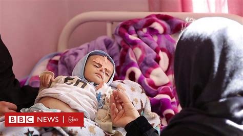 ယီမင်မှာ ဝမ်းရောဂါကူးစက်ခံရသူ ၁ သန်းရှိ Bbc News မြန်မာ